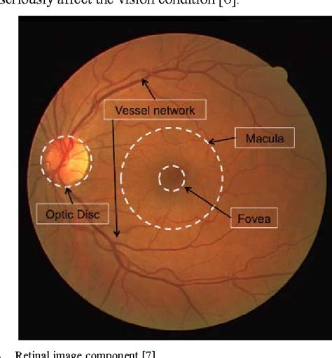 Figure 1 From Automated Segmentation Of Optic Disc Area Using Mathematical Morphology And Active