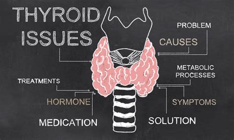 6 Substances That Affect Thyroid Balance Var Medicine Palm Harbor