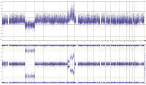 snp array results of a patient with uveal melanoma showing monosomy 3