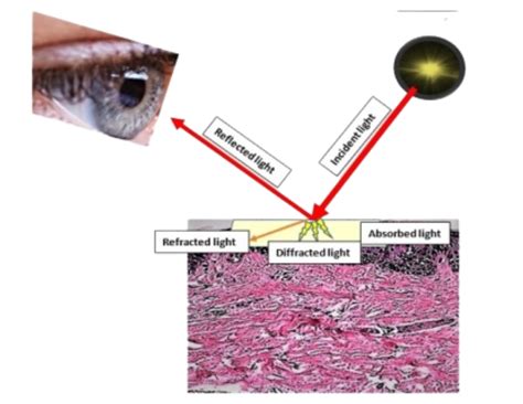 Dermoscopy — Dermapamine By Dermapamine Club