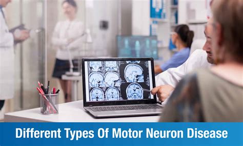 What Are The Different Types Of Motor Neurone Diseasemnd Plexus