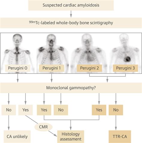 Deep Learning On Bone Scintigraphy To Detect Abnormal Cardiac Uptake At