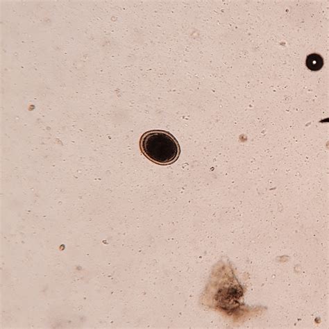 Looking For Parasite Egg Photos And Id Tips Rmicroscopy