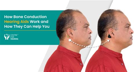Youll Never Believe How Bone Conduction Hearing Aids Work And How