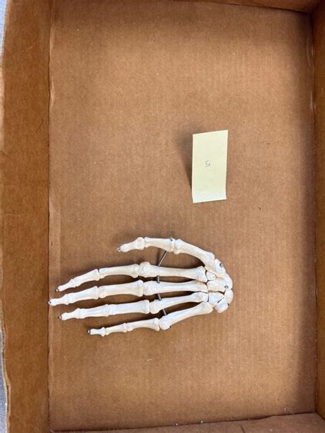 6 5 Describe The Differences Between Chimp And