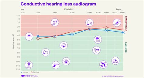 How To Read An Audiogram Essential Types And Symbols