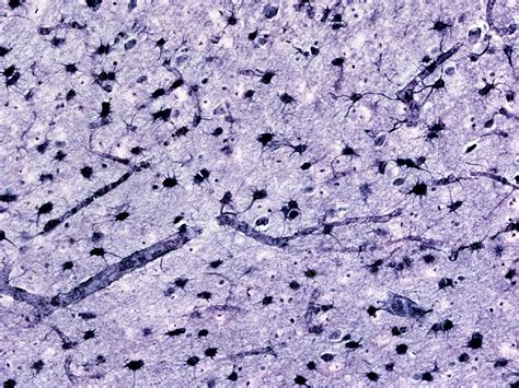 Brain Tissue Light Micrograph Stock Image C024 0106 Science Photo Library
