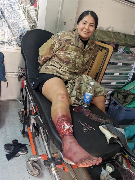 Ready For Anything Jtf Med 374 Conducts Mascal Training Us Army