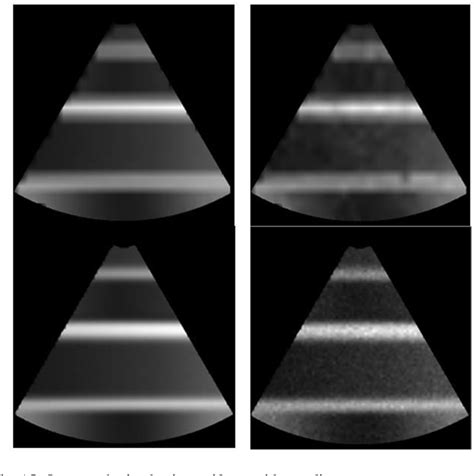 Figure 15 From Synthetic Models Of Ultrasound Image Formation For Speckle Noise Simulation And