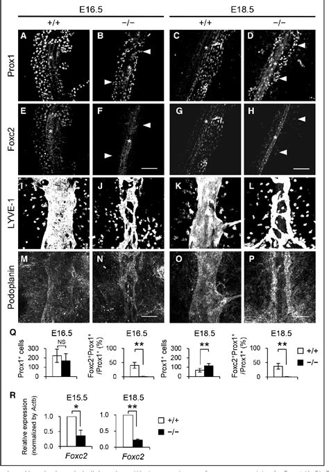 Lymphatic Plexus Semantic Scholar