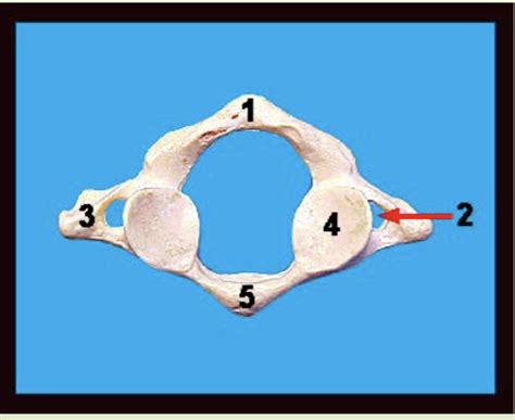The Axis Inferior View Diagram Quizlet