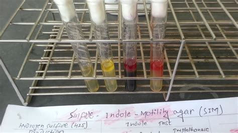 Sim Indole Test