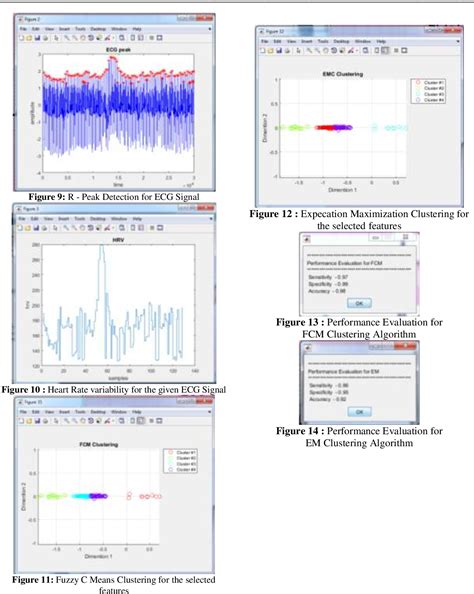Figure 1 From Clustering The Ecg Signals Using Fuzzy C Means Clustering