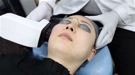 인모드리프팅 Fx 포마 시술장면 Inmode Lifting Mini Fx Forma Youtube