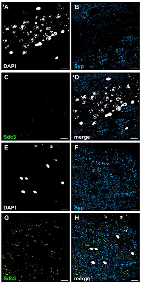 Array Tomography Images Demonstrating Localization Of Download