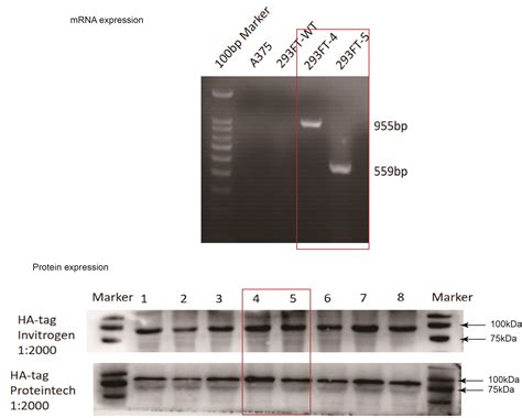 Why Our Truncated Protein Plasmid Expressed Correct Length Of Mrna But