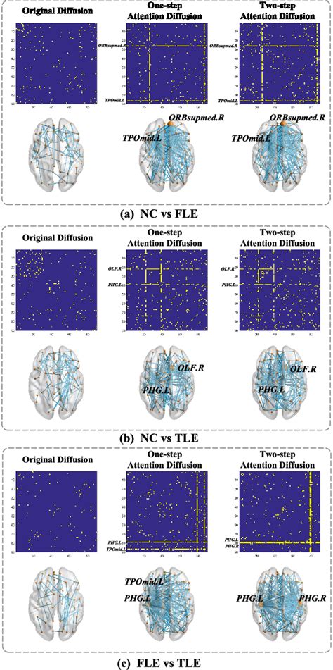 figure 1 from attention diffusion bilinear neural network for brain