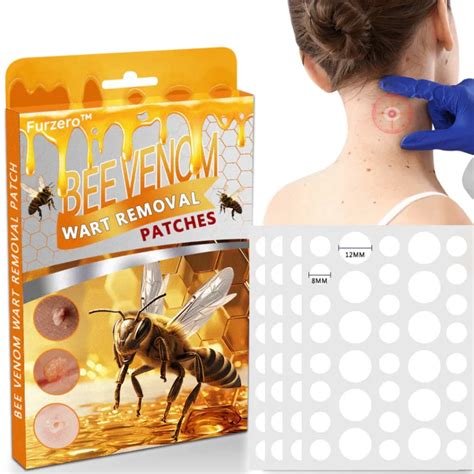 Furzero™ Bee Venom Wart Removal Patch W I Z Z G O O