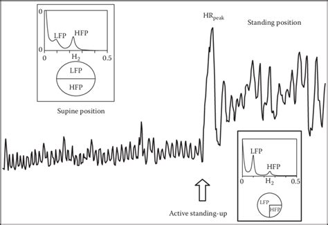 10 Typical Tachogram Of The Heart Rate In Supine Position Active