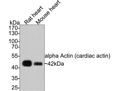 Alpha Cardiac Actin Polyclonal Antibody Pa5 141189