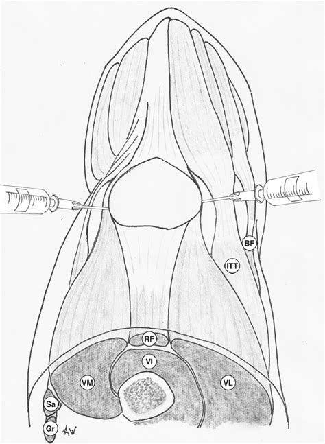 Knee Joint Injection Gpnotebook Knee Joint Injection Gpnotebook