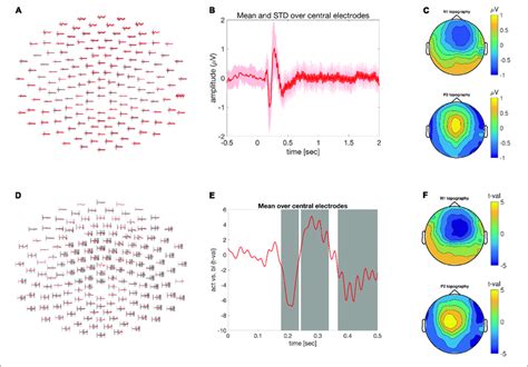 Time Domain Analysis A Grand Average Of The Assr Across Multiple Download Scientific