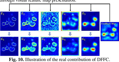 Figure 1 From Dual Feedback Attention Framework Via Boundary Aware Auxiliary And Progressive