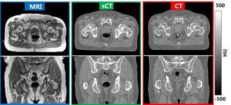 Deep Learning In Radiotherapy Computational Imaging Group