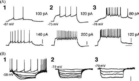Firing Patterns And Response Patterns To Hyperpolarizing Current