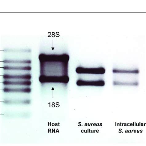 Exemplary Image Of Gel Electrophoresis Of Rna Isolated From Endothelial Download Scientific