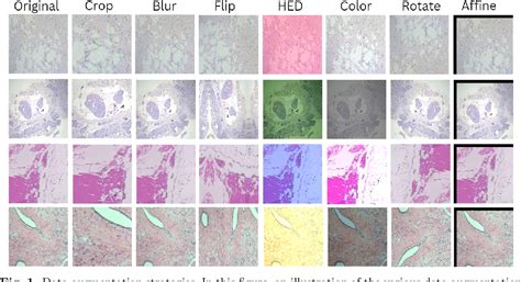 Classification Of Breast Cancer Histopathology Images Using A Modified