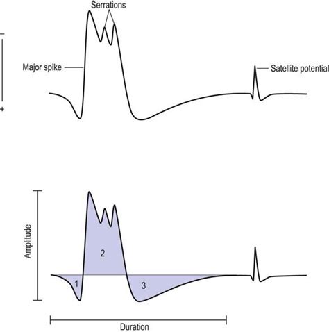 Basic Electromyography Analysis Of Motor Unit Action Potentials