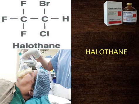 Halothane Induced Hepatitis Pptx
