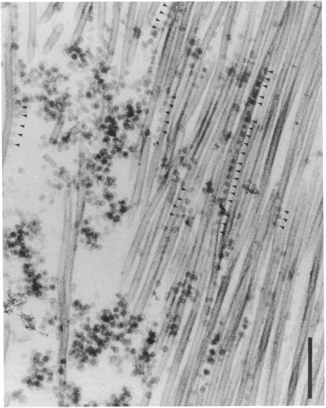 Cytoskeleton Electron Micrograph