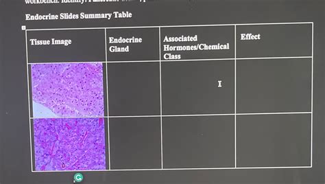 Solved Anatomy And Physiology Endocrine Slides Summary Table Tissue Course Hero