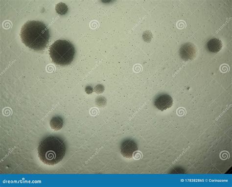 Candida Albicans Colonies Under The Microscope Stock Image Image Of