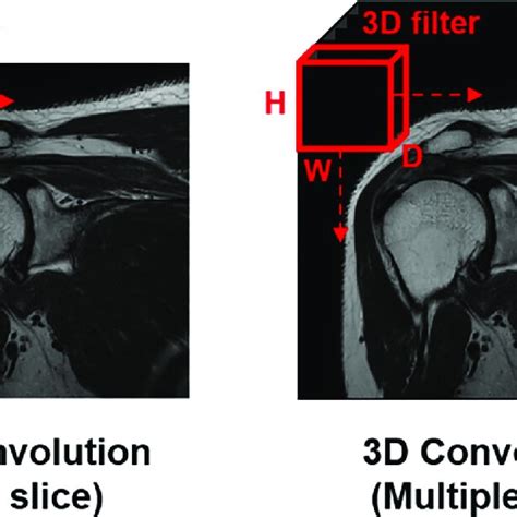 comparison between 2d and 3d convolutional calculation the number of