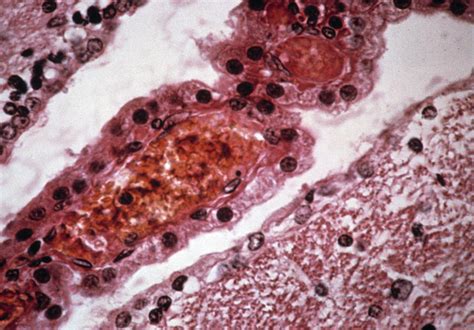Choroid Plexus In Brain Photograph By Cnri Science Photo Library Pixels