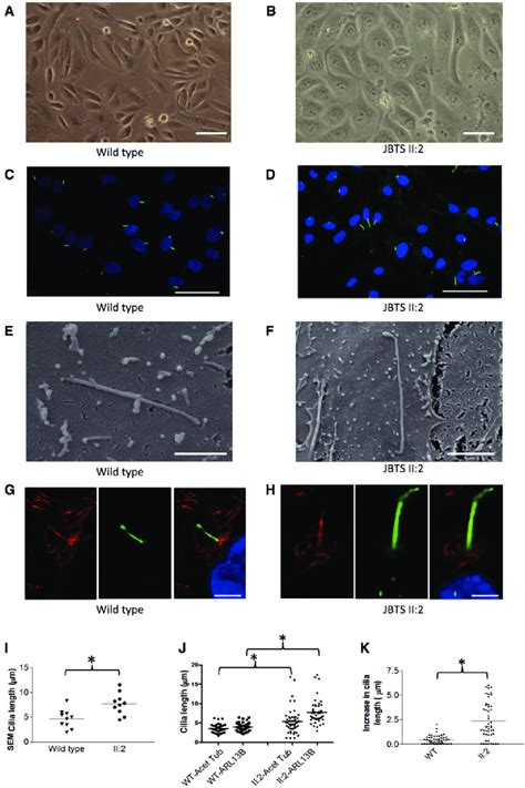 Renal Epithelial Cilia Derived From A Patient With Cep290 Mutations