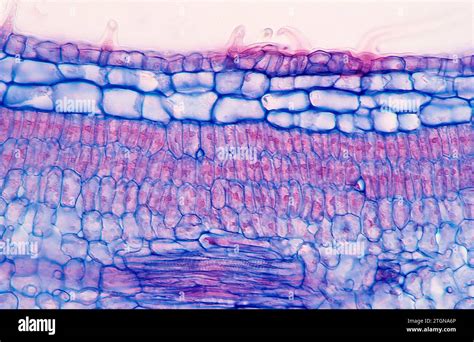 Leaf Cross Section Showing Epidermis With Trichomes Palisade Parenchyma And Xylem