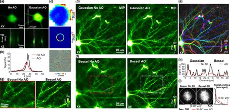Ao Improves Volumetric Imaging Of Dendritic And Synaptic Morphology Of