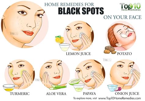 Face Mask Home Remedies For Dark Spots At Georgia Challis Blog