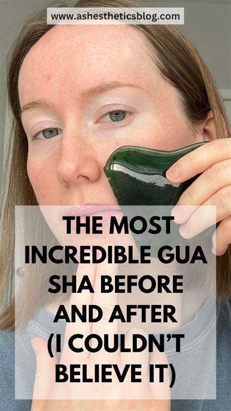 Insane Gua Sha Before And After Using Danna Omari Gua Sha Ash