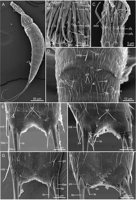 Scanning Electron Micrographs Showing Overview And Details In Head And Download Scientific