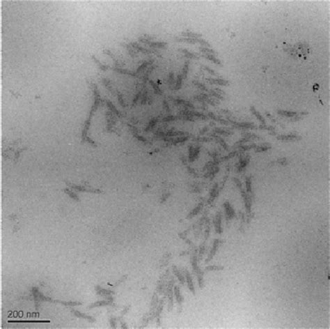 Tem Of Silver Hydroxyapatite Pvp Composite Material Download Scientific Diagram