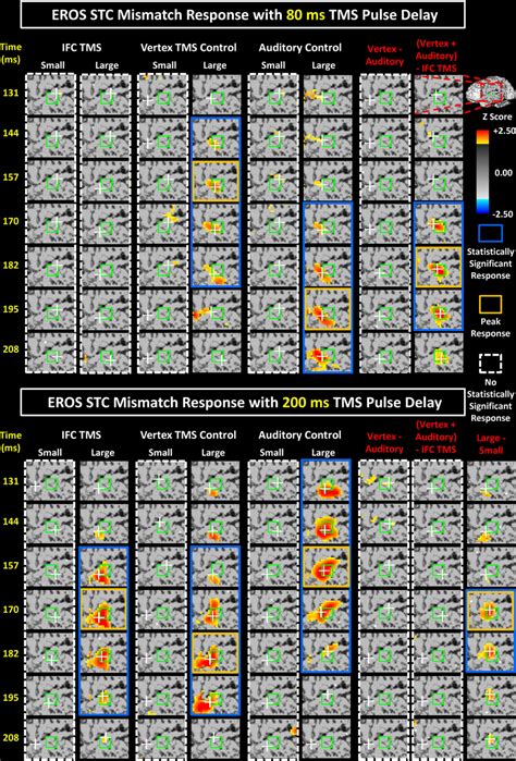 statistical maps of the eros stc mismatch responses projected onto left