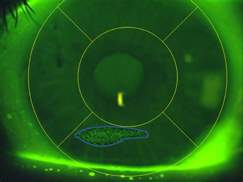 The Blue Outline Illustrates The Extent To Be Allocated To Punctate Download Scientific Diagram