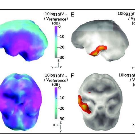 Figure E Sensitivity Maps For Ear Eeg A B Sensitivity Map For A