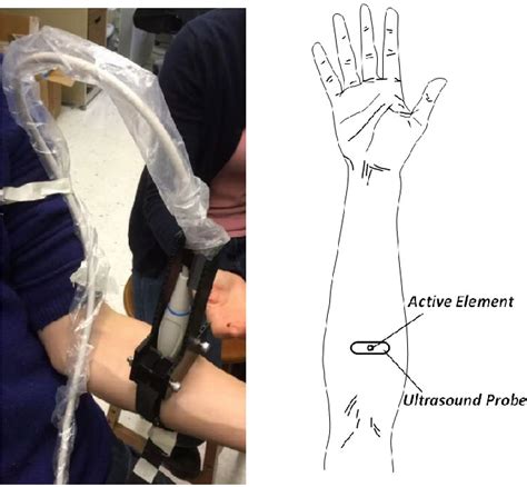 figure 1 from low latency gesture recognition from spatial filtering of