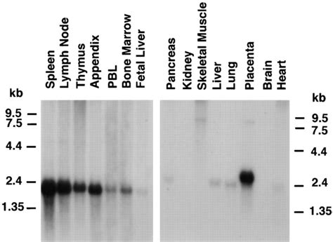 The Expression Of Strl33 In Human Tissues Blots Were Prepared By The